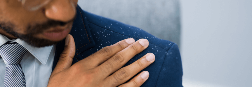 Forfora: Cause, Sintomi e Rimedi